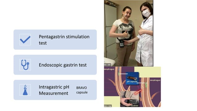 Zollinger ellison syndrome | PPTX | Endocrine and Metabolic Diseases ...