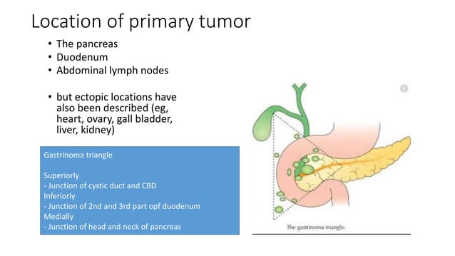 Zollinger ellison syndrome | PPTX | Endocrine and Metabolic Diseases ...
