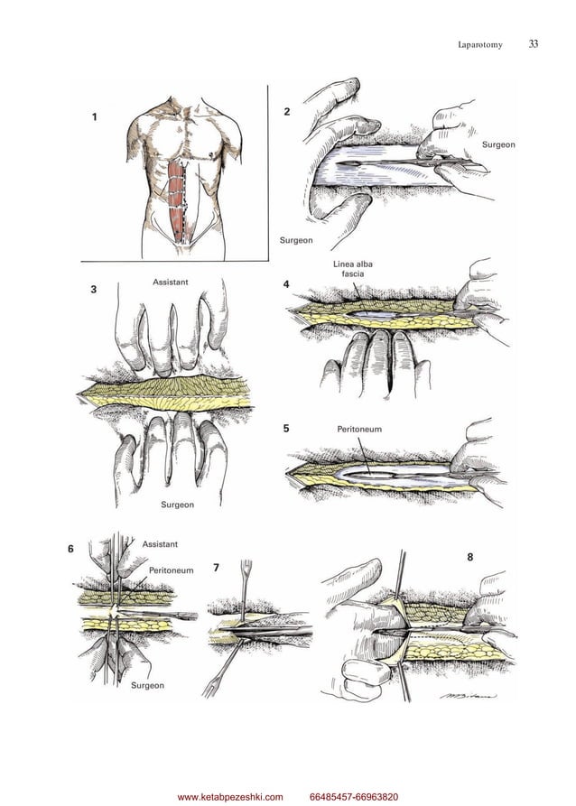 Zollinger’s Atlas of Surgical Operations-McGraw-Hill (2016).pdf ...