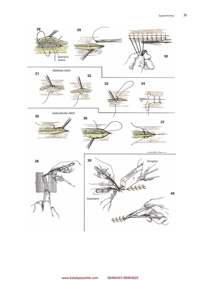 Zollinger’s Atlas of Surgical Operations-McGraw-Hill (2016).pdf ...