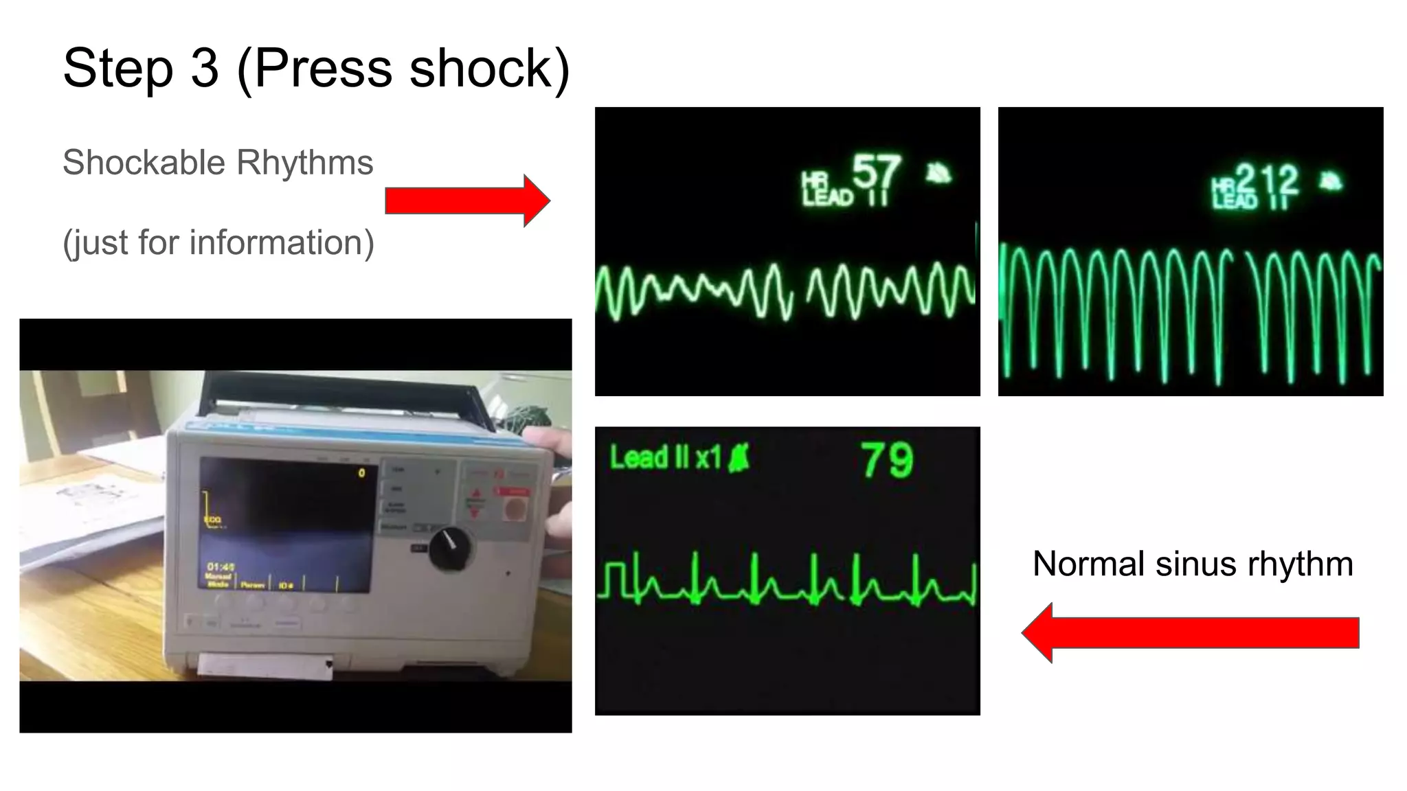 Zoll m series | PPTX