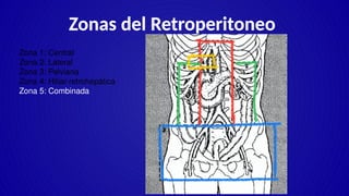 Zonas del retroperitoneo en trauma abdominal.pptx