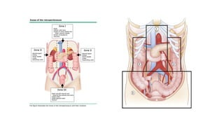 Zonas del Retroperitoneo en Trauma Abdominal | PPTX