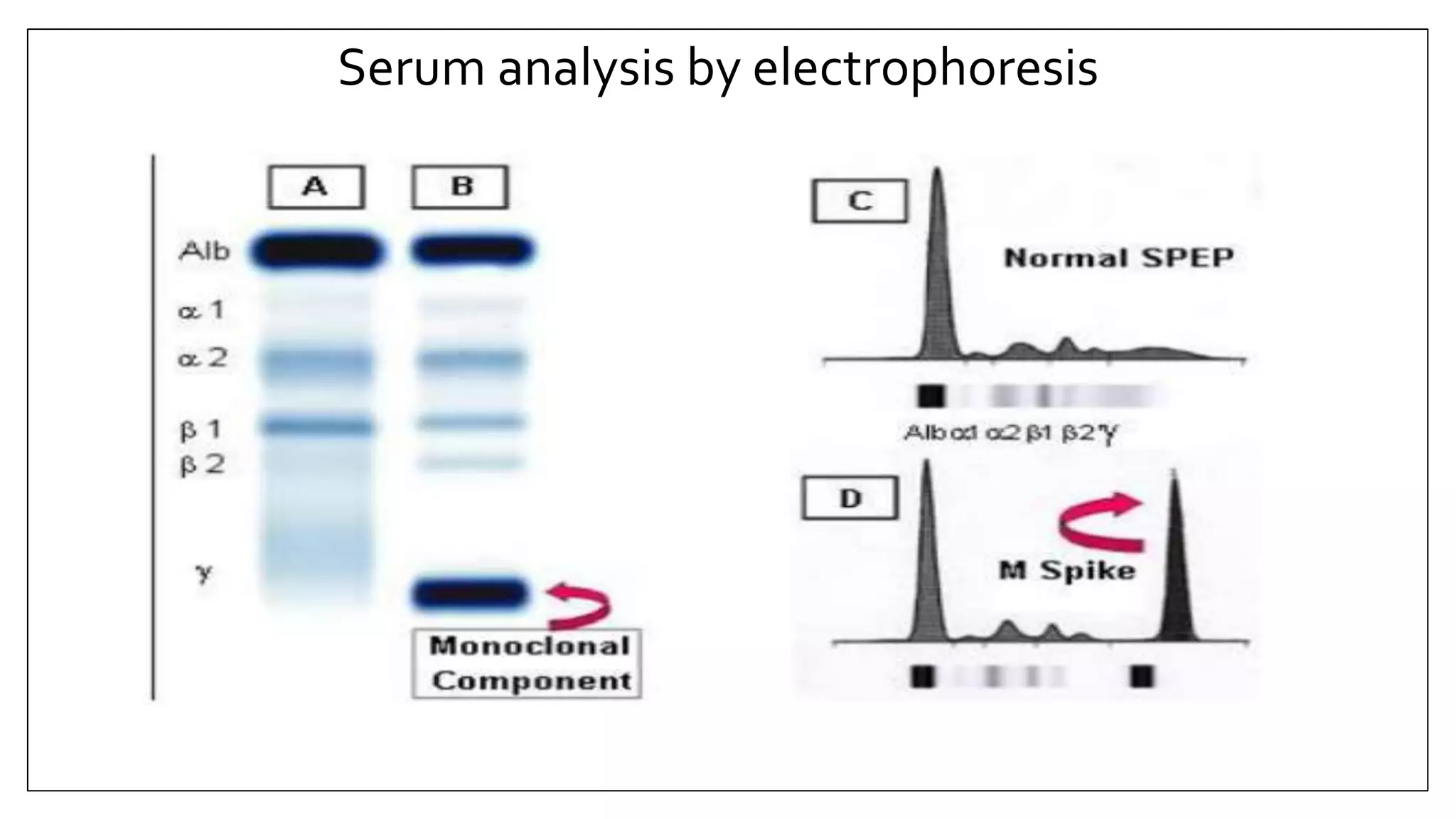 Zone electrophoresis and its types | PPTX