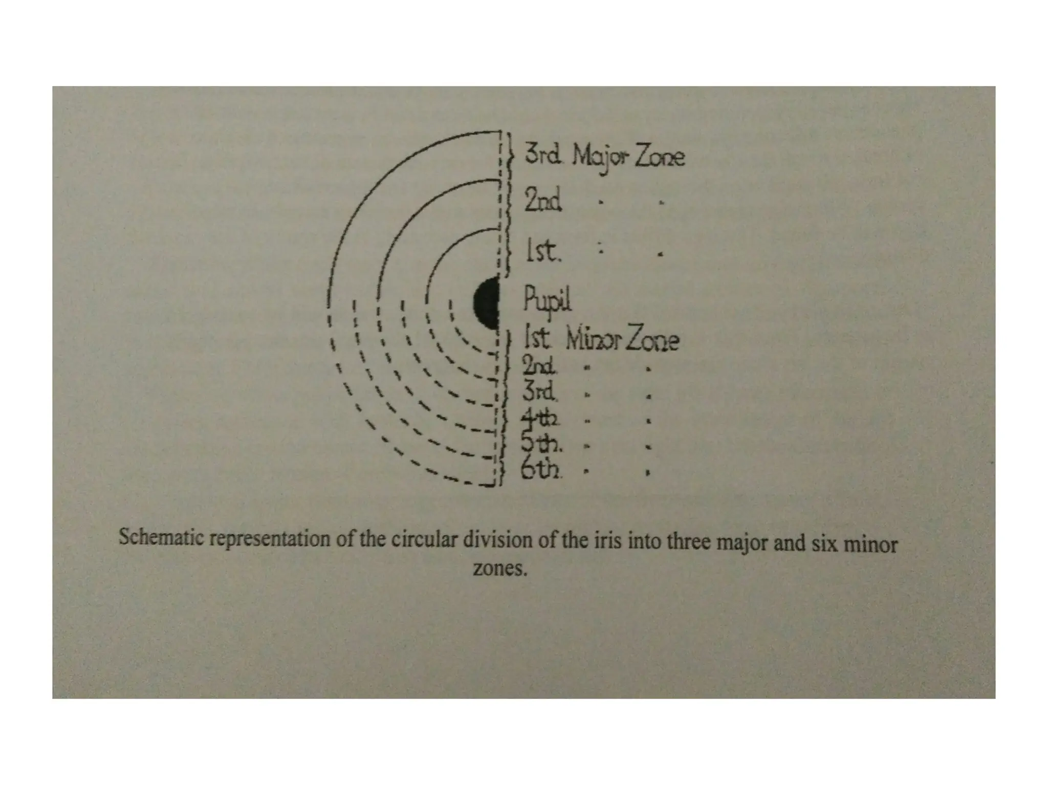 zones of iris-1.pptx zones of iris zones | PPTX