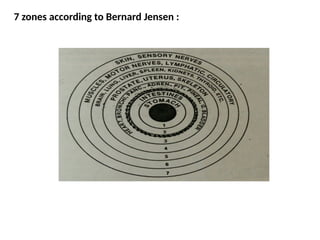 zones of iris-1.pptx zones of iris zones | PPT