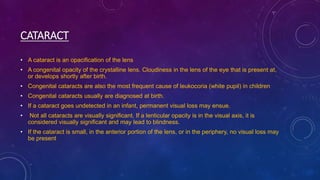 Zonular cataract | PPTX