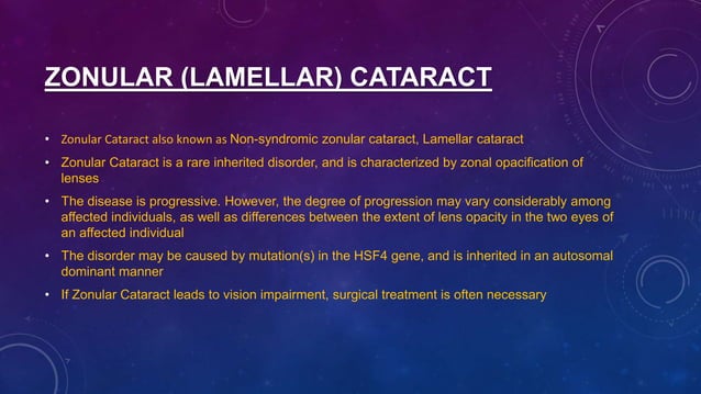 Zonular cataract | PPTX