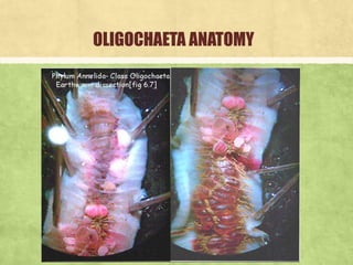 Oligochaeta Dissection