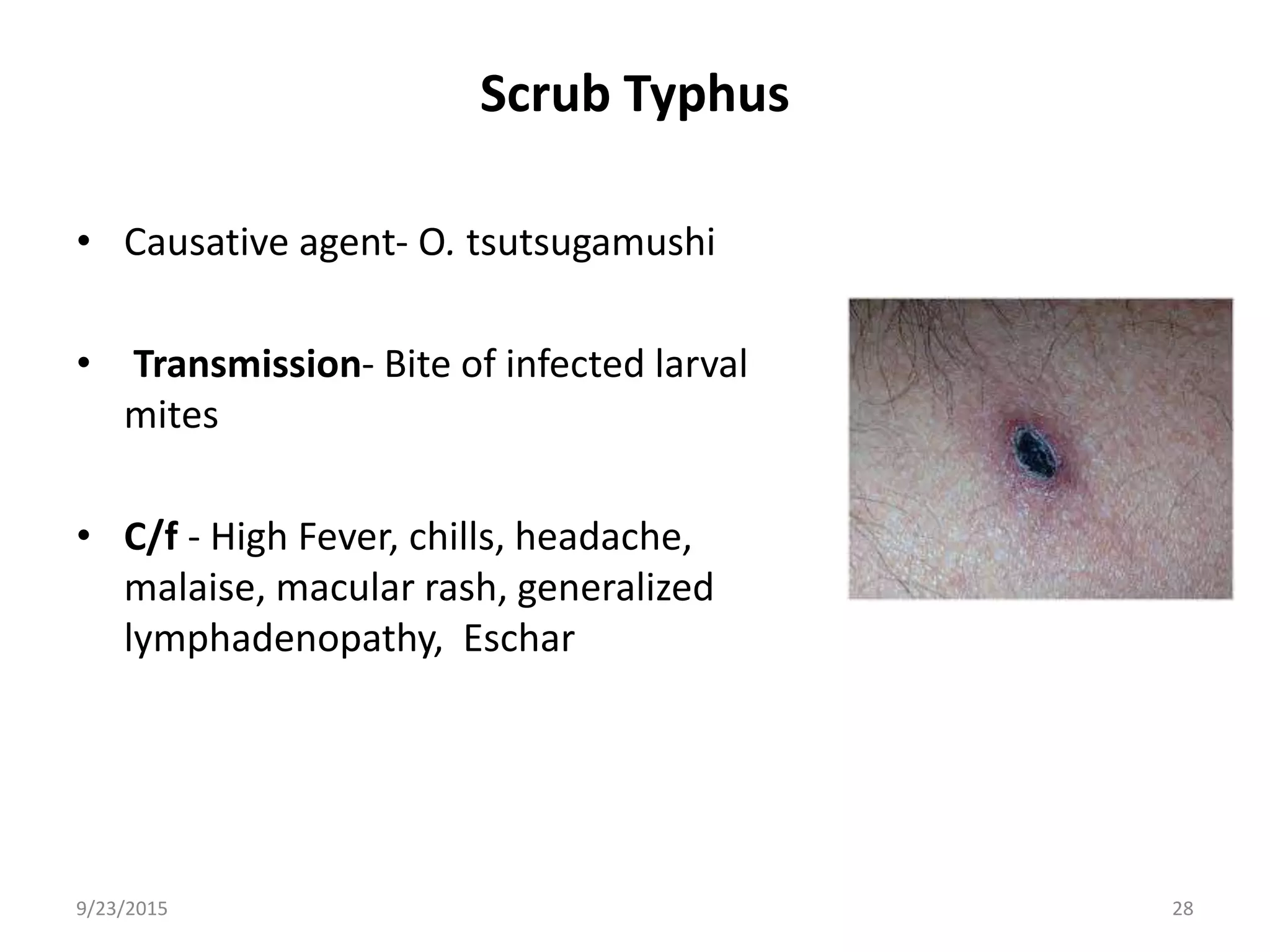 Zoonotic disease | PPTX