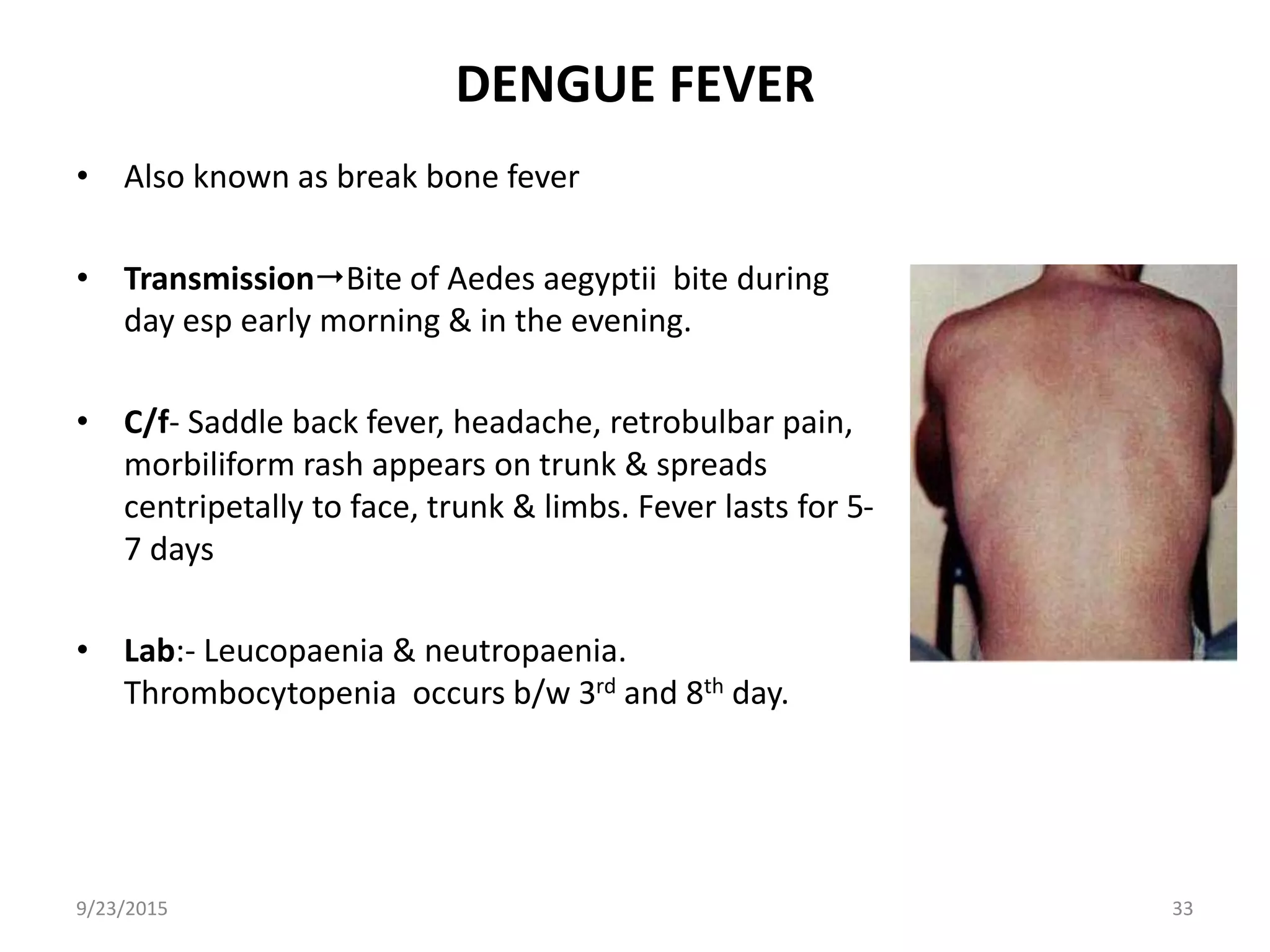 Zoonotic disease | PPTX