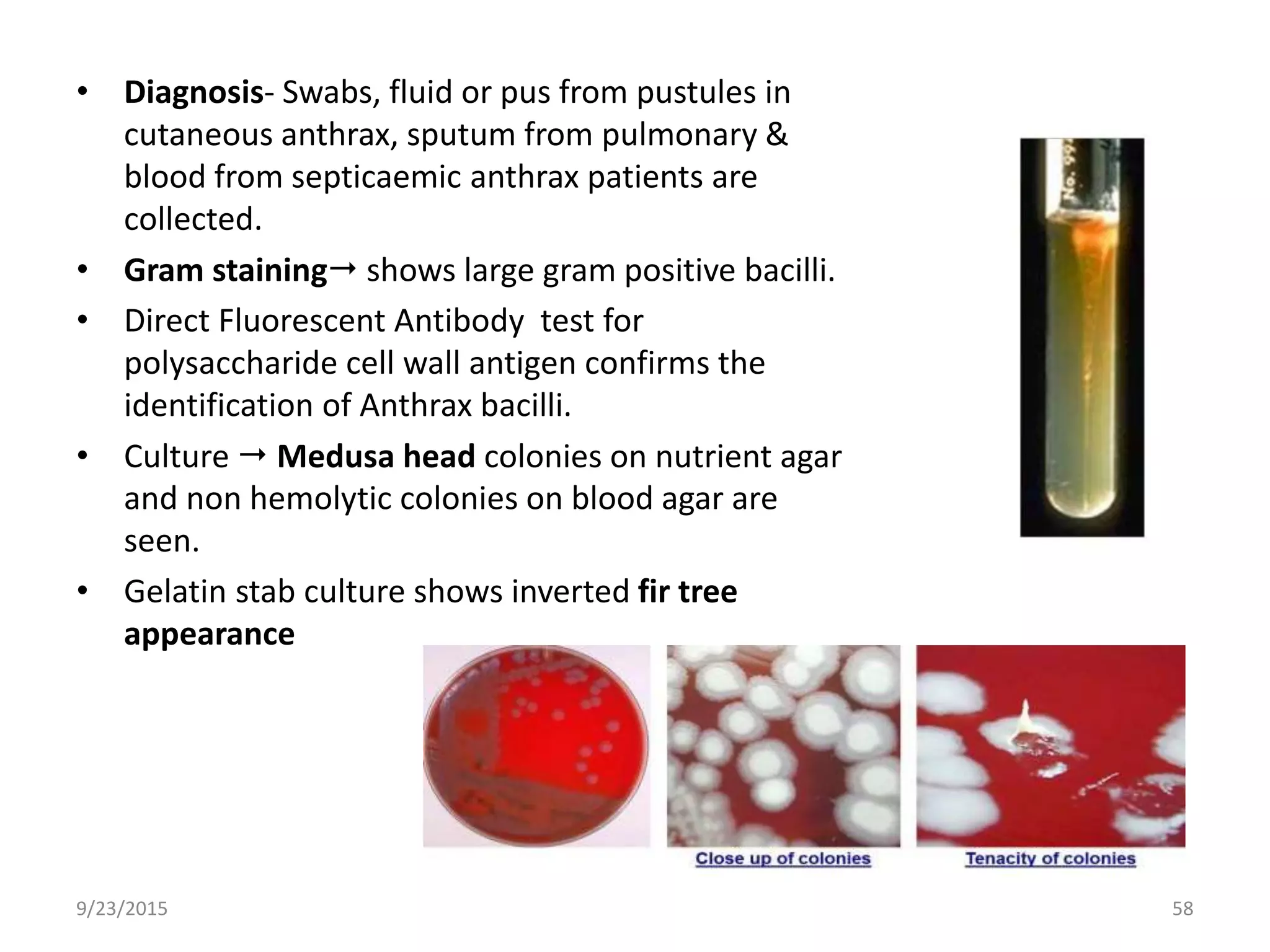 Zoonotic disease | PPTX