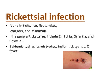 zoonotic infection.pptx for students education | PPTX