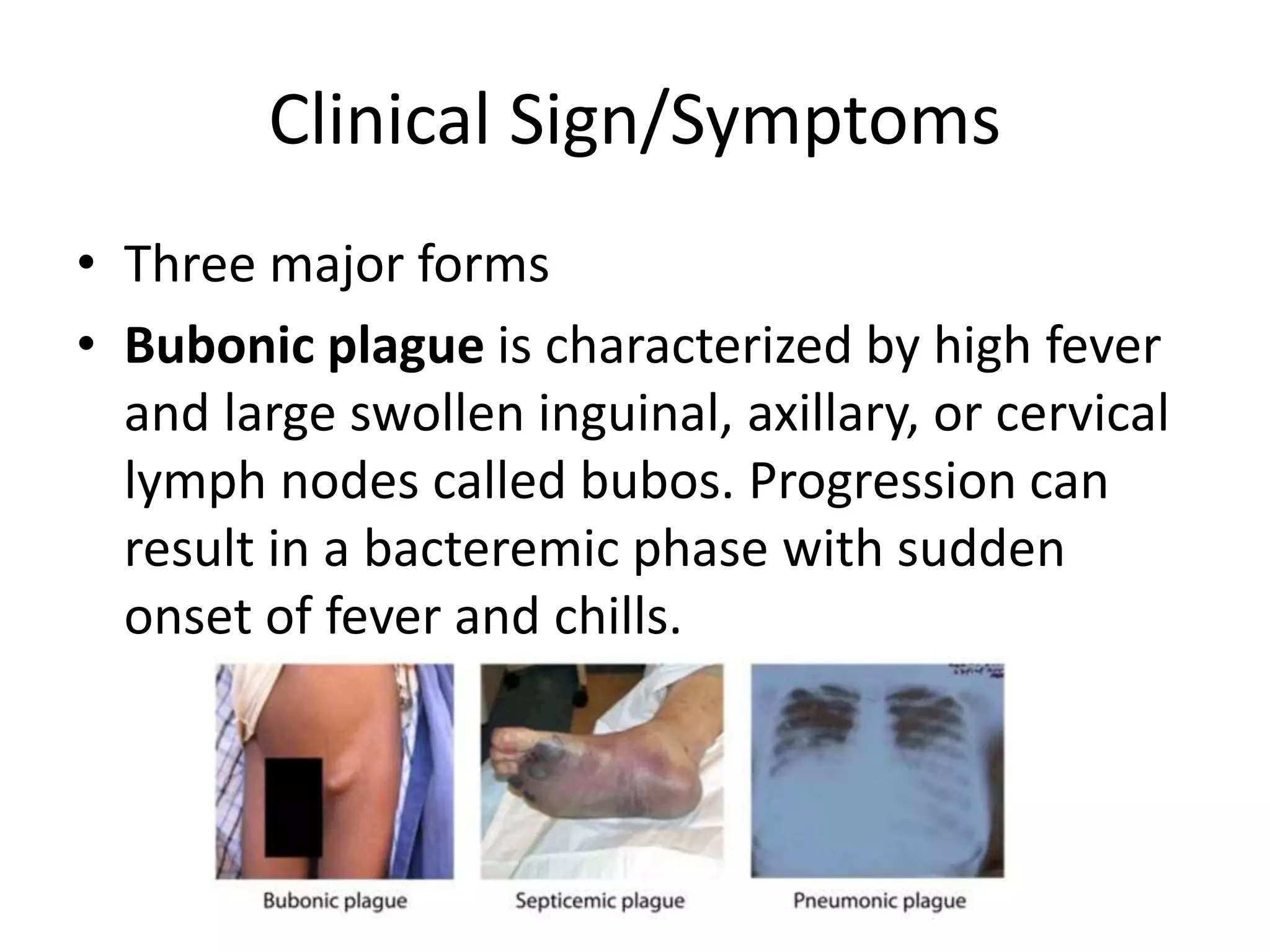 Zoonotic infections.ppt