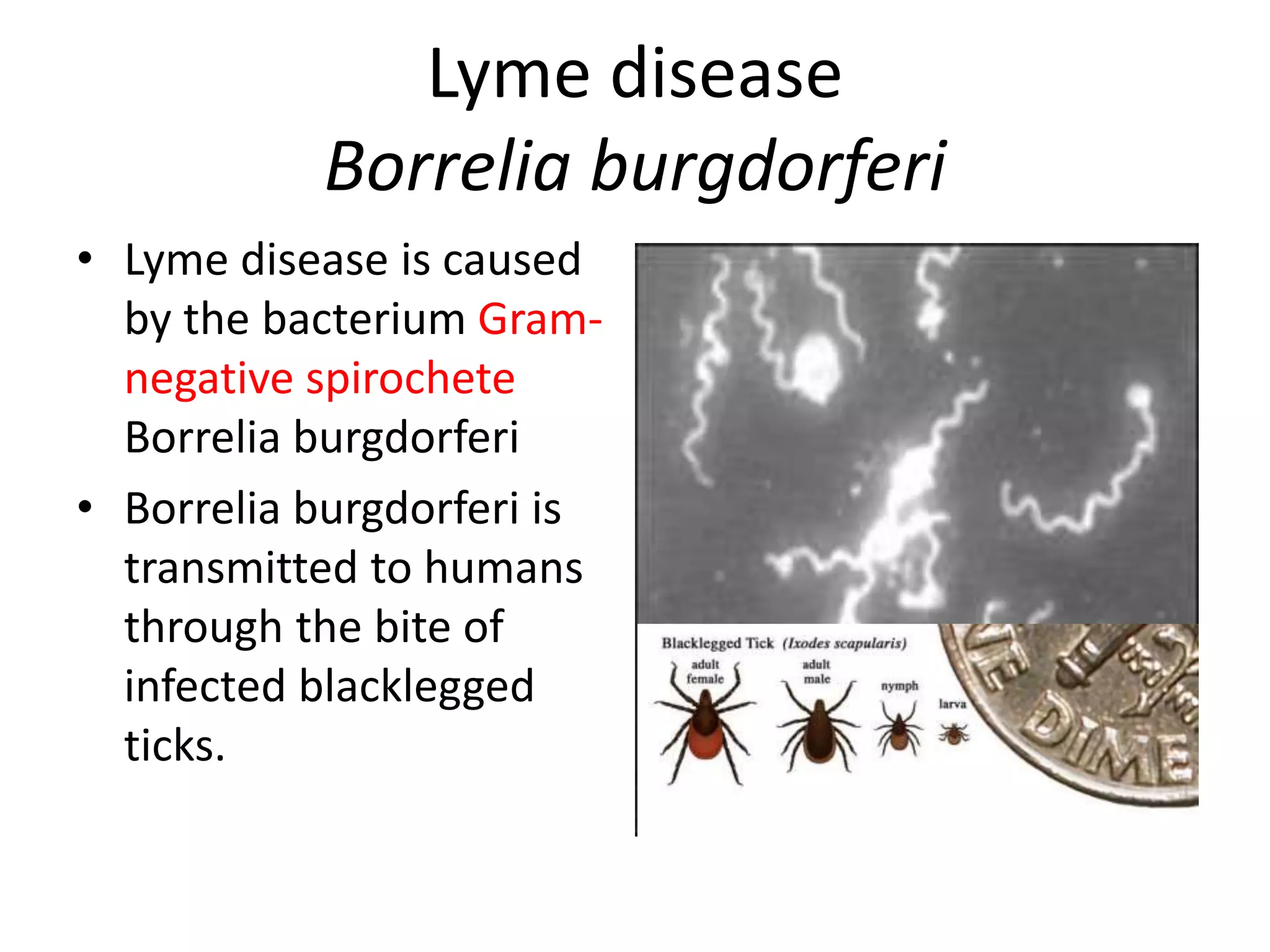 Zoonotic infections.ppt