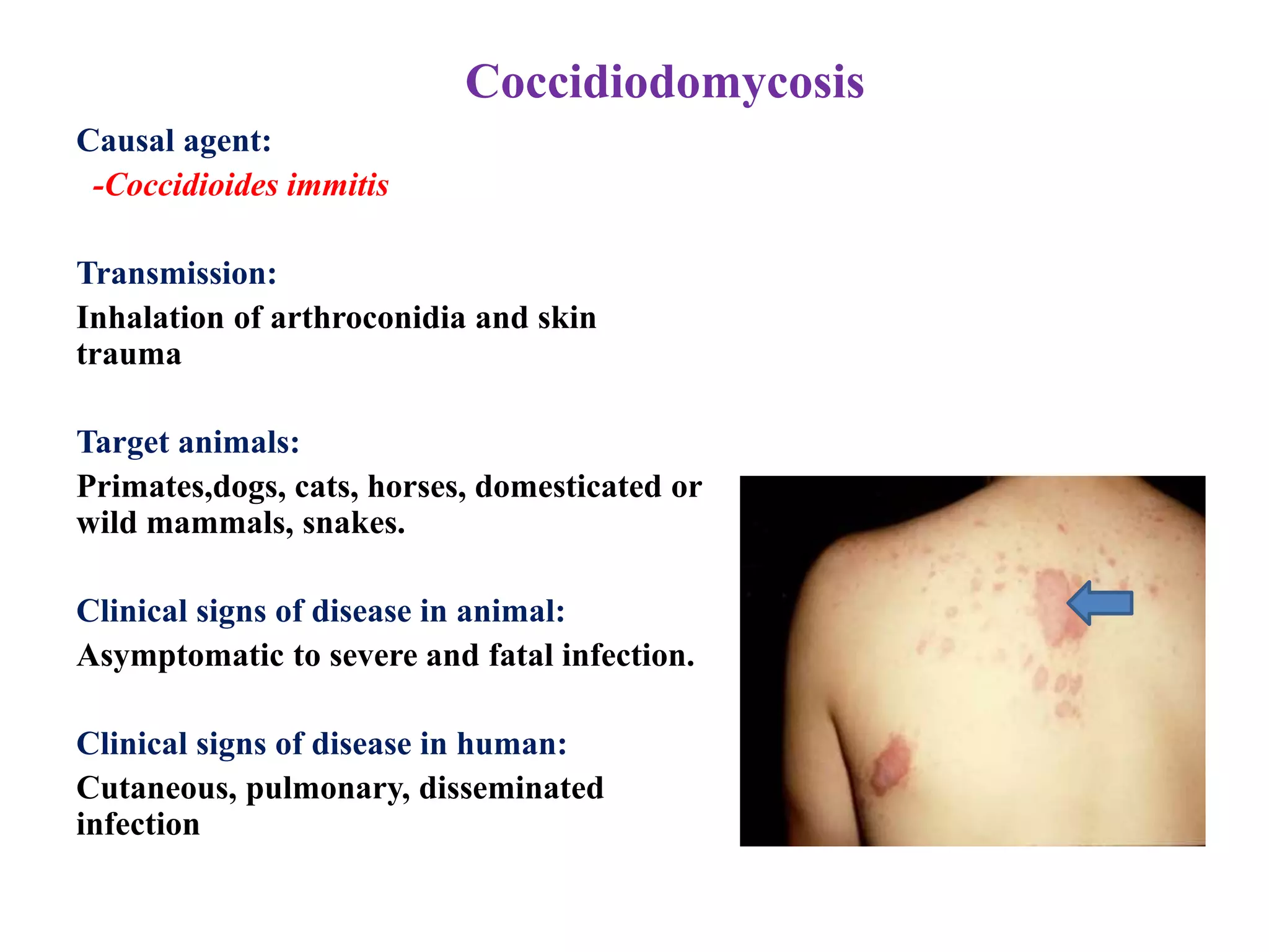 The zoonotic and public health importance of fungus | PPTX
