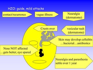 Zoster.................................. | PPT