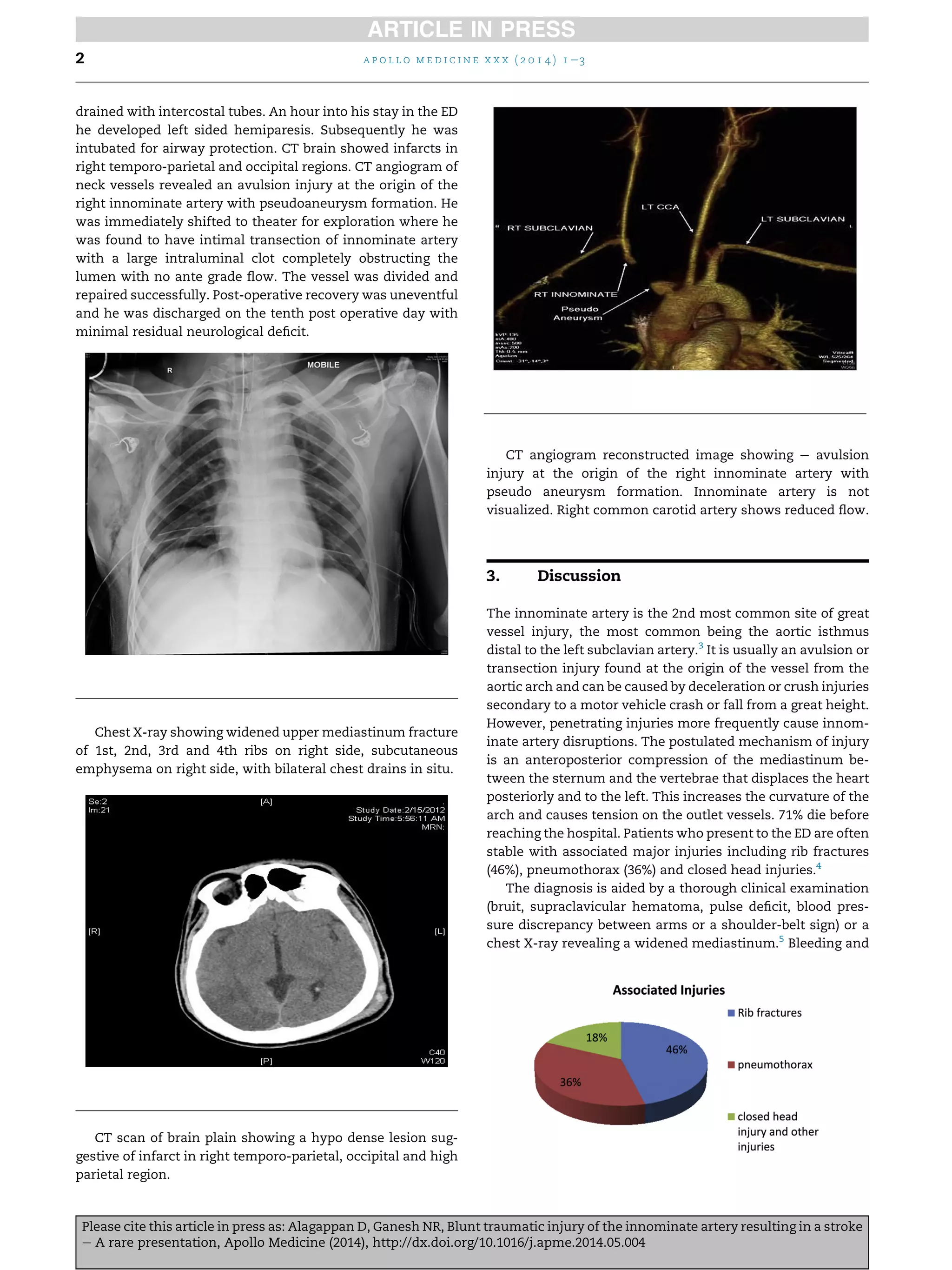Blunt traumatic injury of the innominate artery resulting in a stroke ...