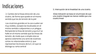 Z plastia Modulo de cirugia genral Medicina | PPTX