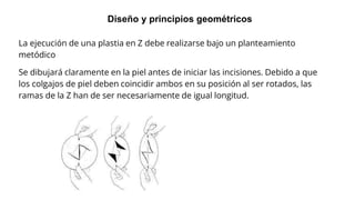 Z plastia Modulo de cirugia genral Medicina | PPTX
