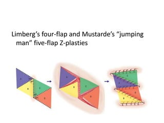 Z plasty in scar contracture release | PPTX