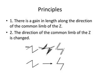 Z plasty in scar contracture release | PPTX