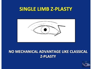 Z PLASTY .pptx
