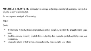 Z plasty and its variations SA. - usefulness applications | PPTX