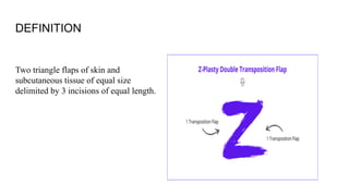 Z plasty and its variations SA. - usefulness applications | PPTX
