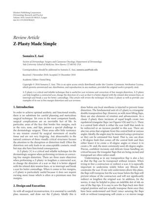 Z plasty made simple | PDF