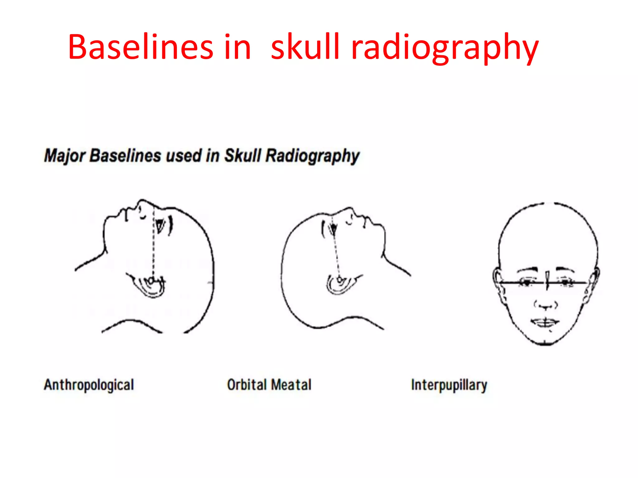 SKULL_RADIOGRAPHY.G.pptx
