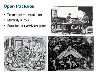 Open fractures | PPT