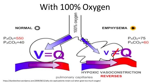 Myths in ICU: BUSTED by Team Thomas