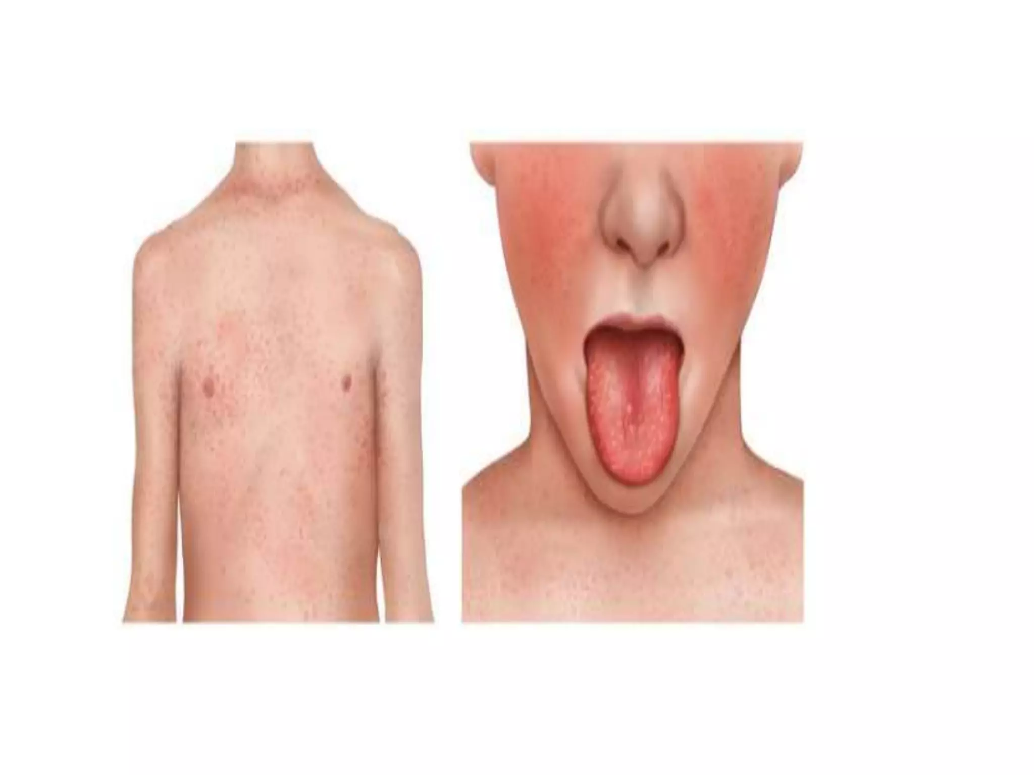 rashes - different types of rashes & diagnosis | PPTX
