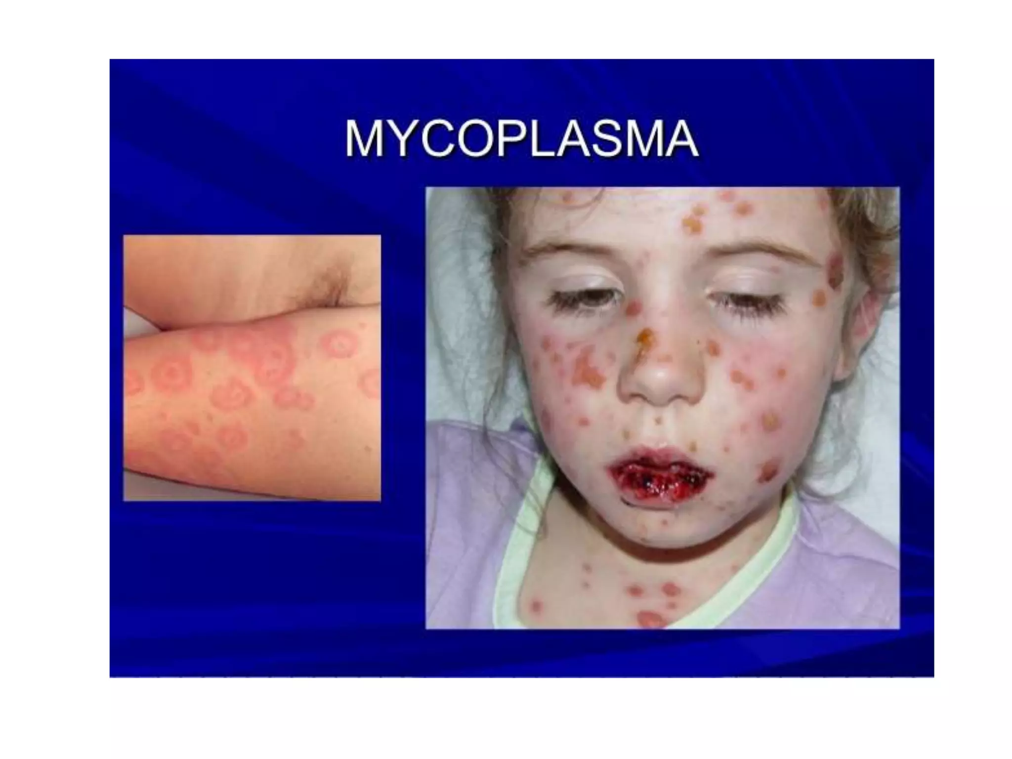 rashes - different types of rashes & diagnosis | PPTX