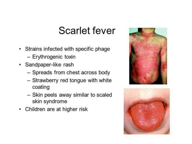 rashes - different types of rashes & diagnosis | PPTX | Infectious ...