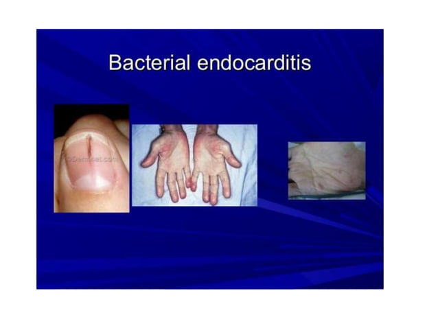 rashes - different types of rashes & diagnosis | PPTX | Infectious ...