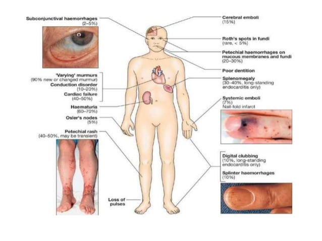 rashes - different types of rashes & diagnosis | PPTX | Infectious Diseases | Diseases and ...