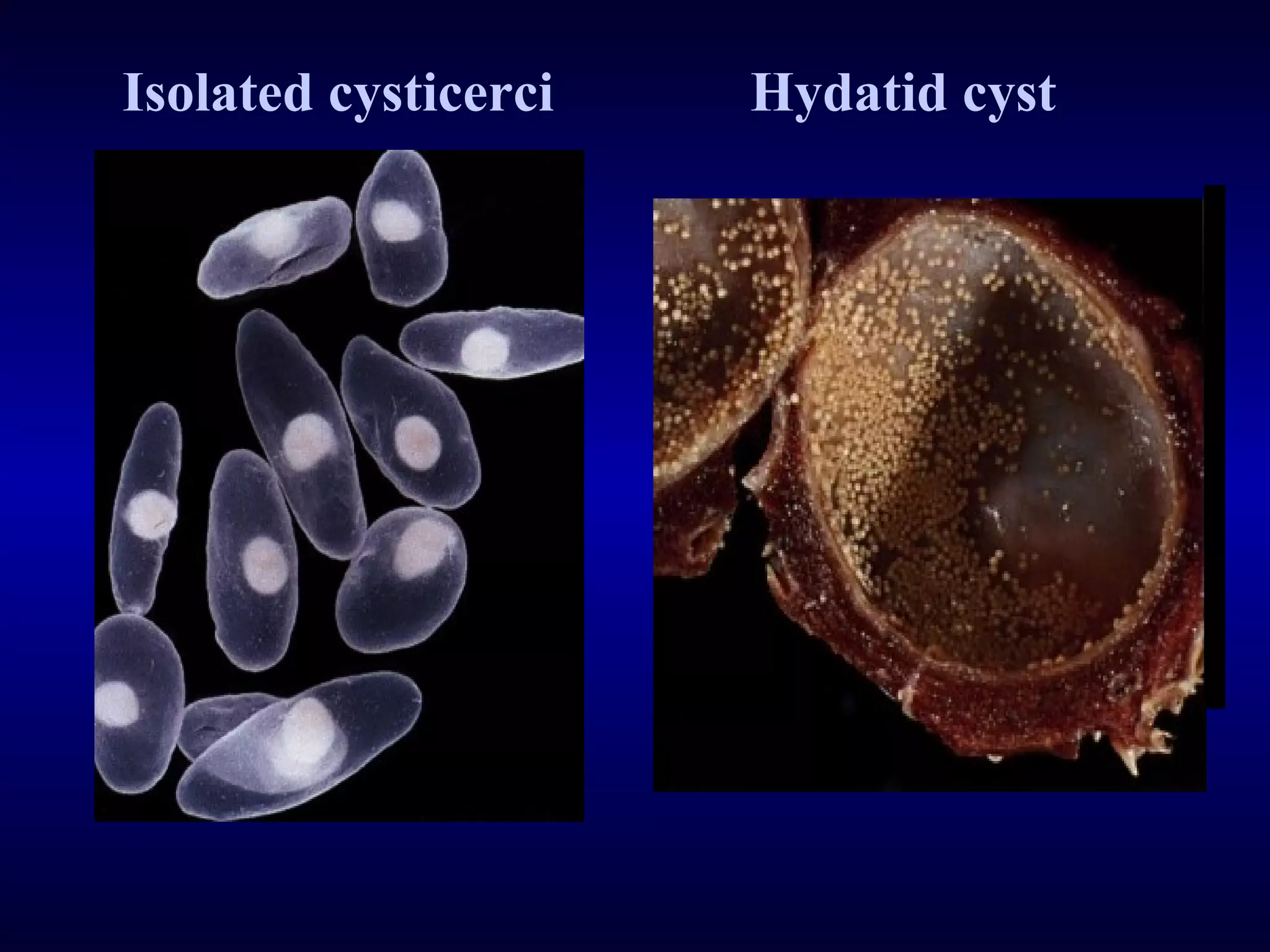 helminthic infection | PPT