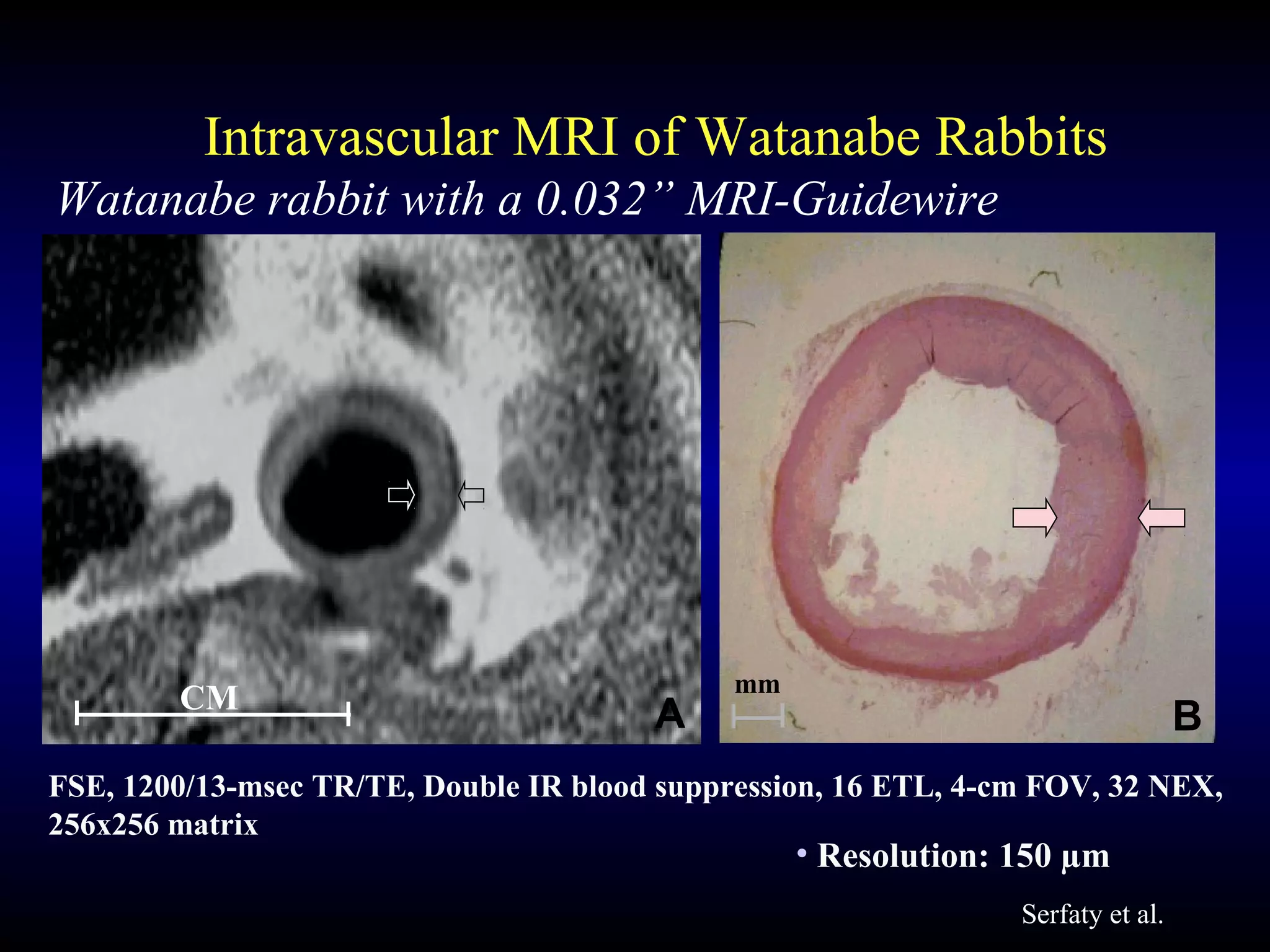 089 intravascular magnetic resonance imaging | PPT