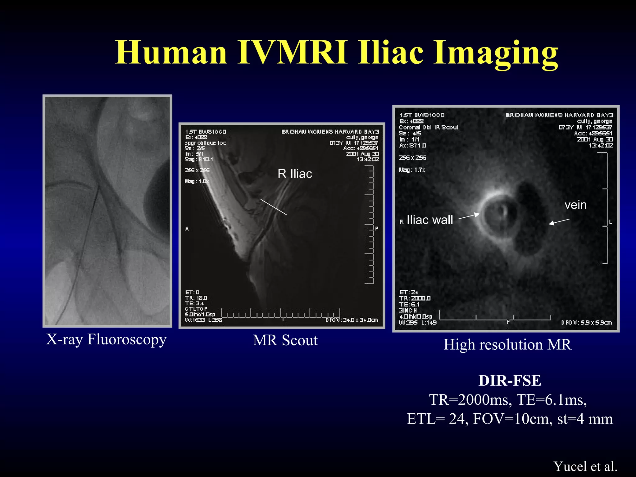 089 intravascular magnetic resonance imaging | PPT