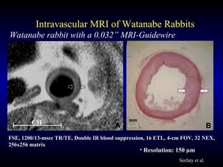 089 intravascular magnetic resonance imaging | PPT