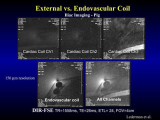 089 intravascular magnetic resonance imaging | PPT