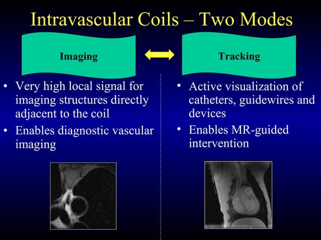 089 intravascular magnetic resonance imaging | PPT