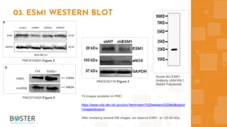 Learn ESM1 in 3 minutes | Endothelial cell-specific molecule 1, Endocan ...