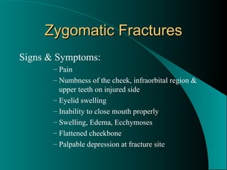 zygomatic bone fractures presentation.ppt