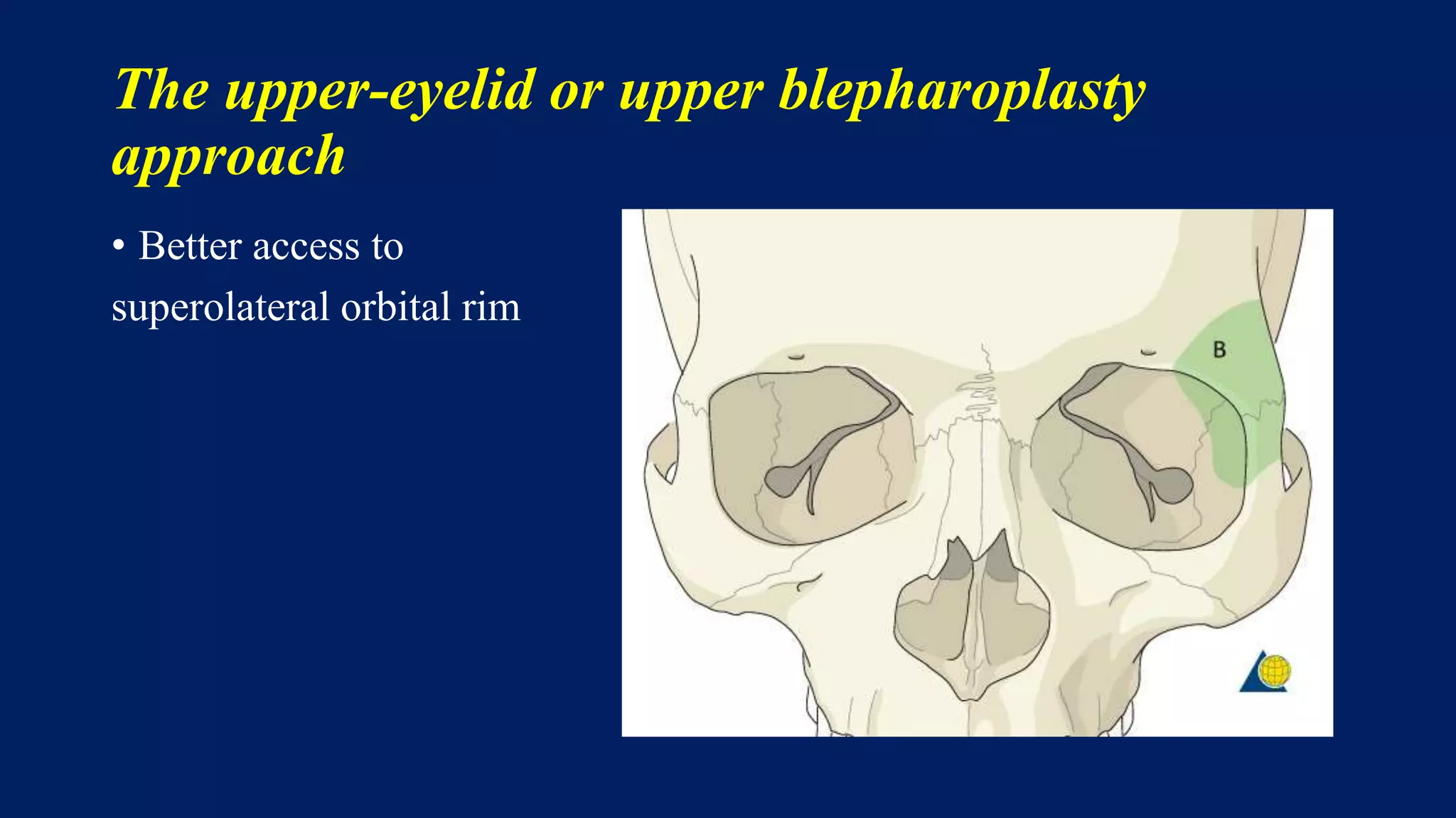 Zygoma fractures | PPTX