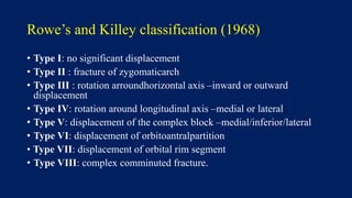 Zygoma fractures | PPTX
