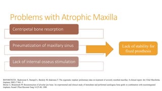 ZYGOMATIC AND PTERYGOID IMPLANTS.pptx