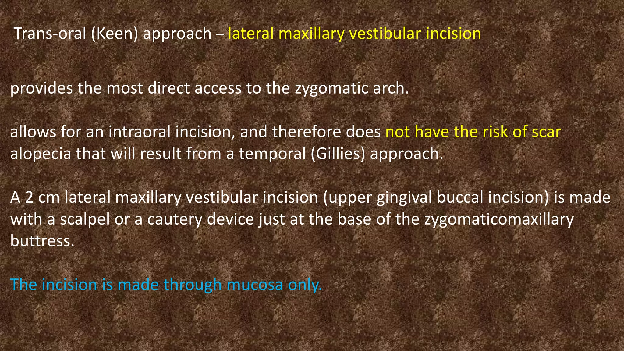 Zygomatic arch fracture | PPTX